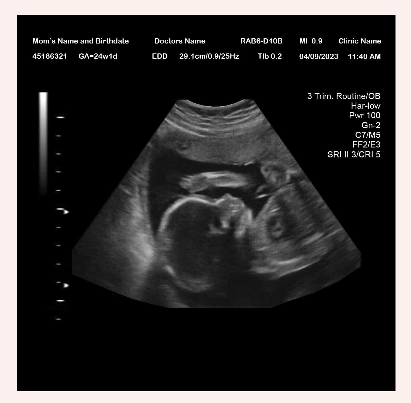 23 Week Ultrasound - Ultrasounds